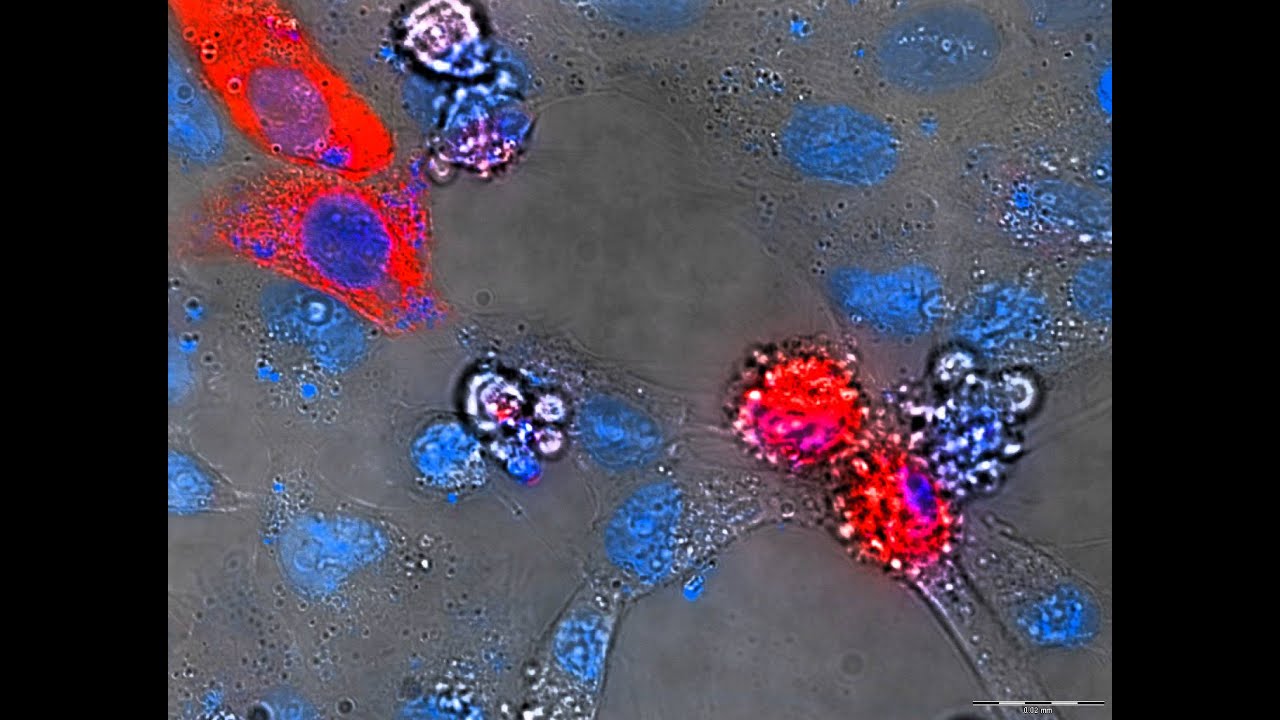 Live Cell Imaging Endoplasmic Reticulum and Nucleus 15 hours 2012 ...