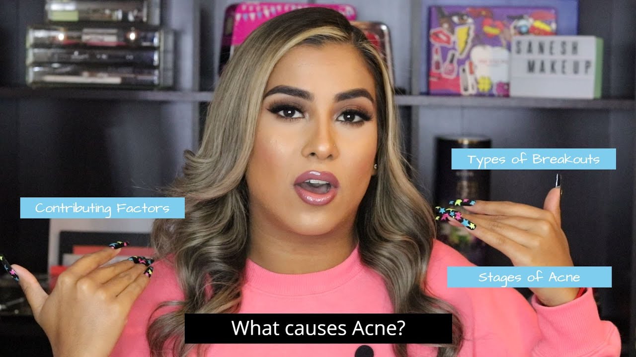 What causes Acne? || Acne Series: Ep.1 - YouTube