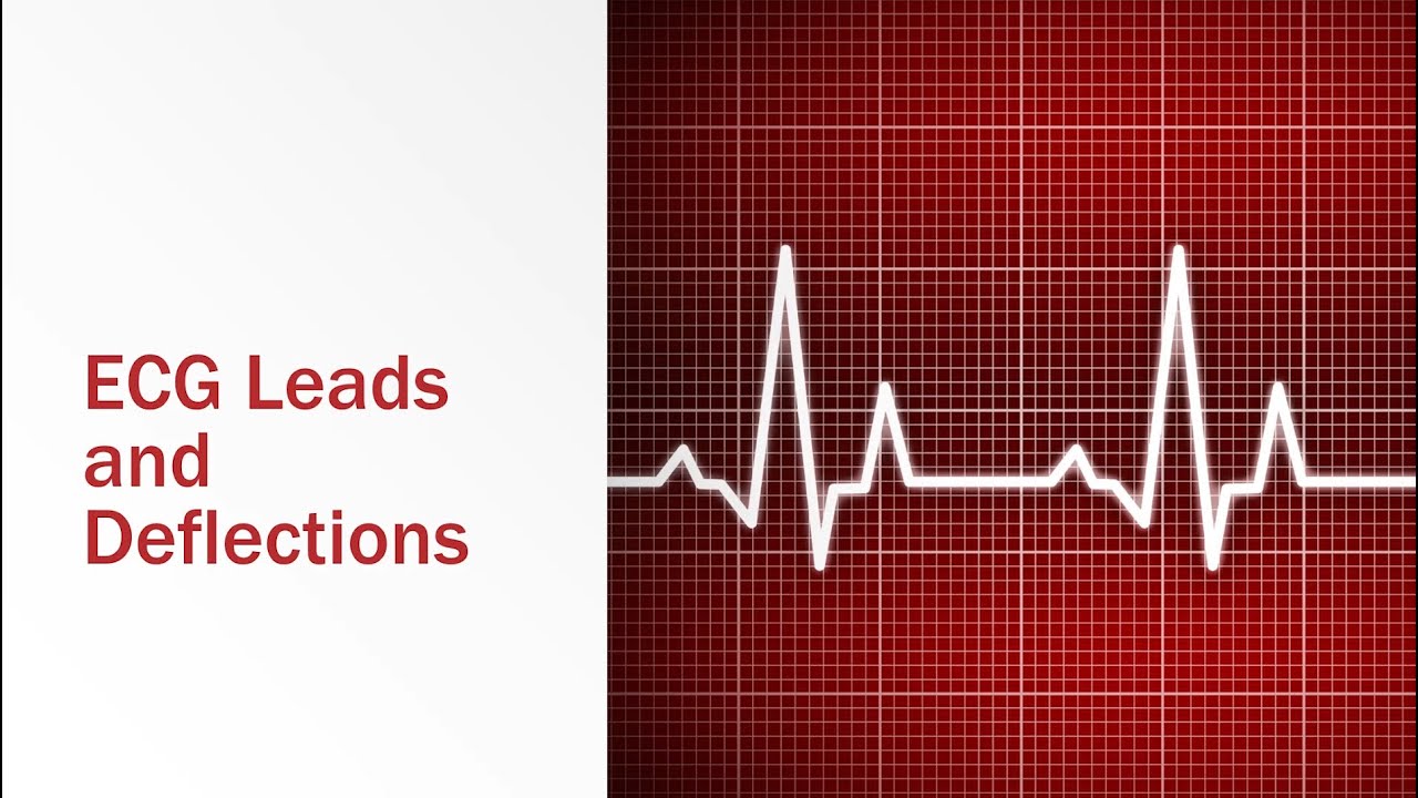 ECG Leads and Deflections - YouTube
