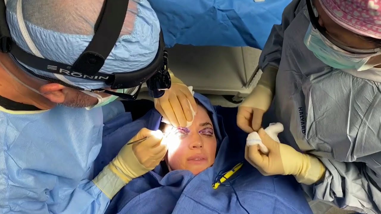 Cary Deuber plastic surgery by her husband Mark Deuber, MD - YouTube