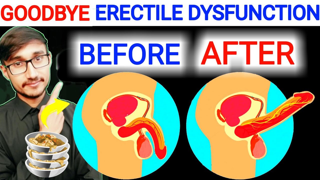How to Improve Erectile Dysfunction Naturally | Best Foods, Exercises, and Lifestyle Tips - YouTube