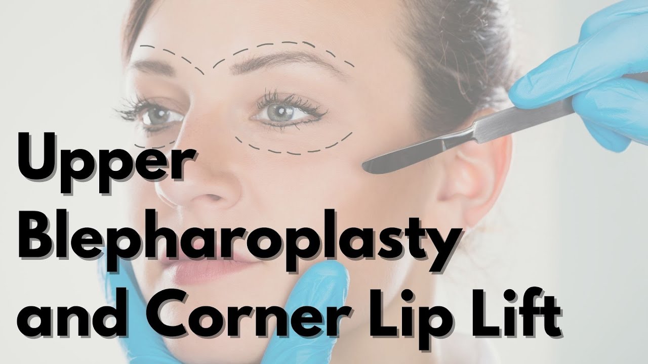 Eyelid Surgery and Corner Lip Lift | Dr. Sarah Mess - YouTube