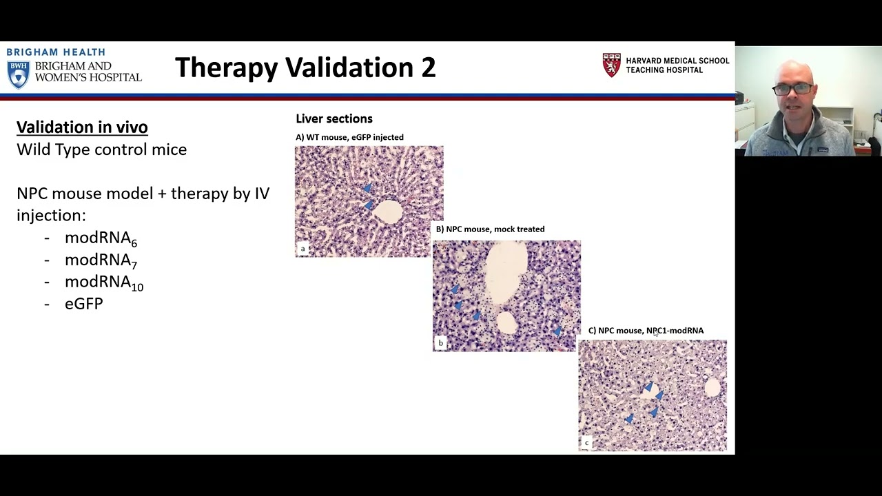 Nick Todd: Enhancing Delivery of Molecular Therapies to the CNS for ...