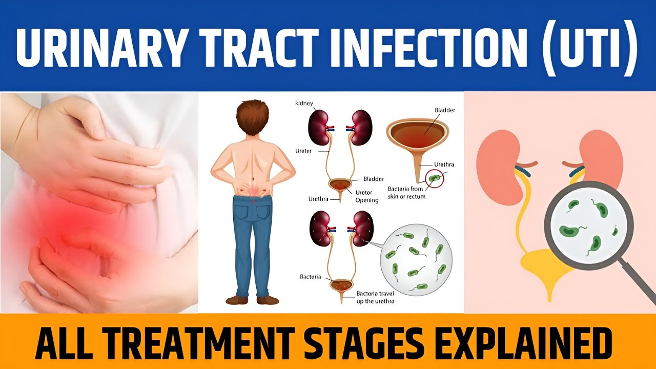 Urinary Tract Infection | UTI Stages and Types | UTI Sign and Symptoms ...