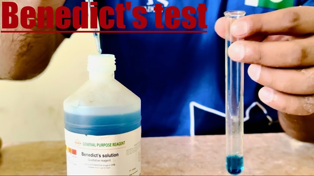 Benedict's test for sugar || Benedict’s solution test || Test for ...
