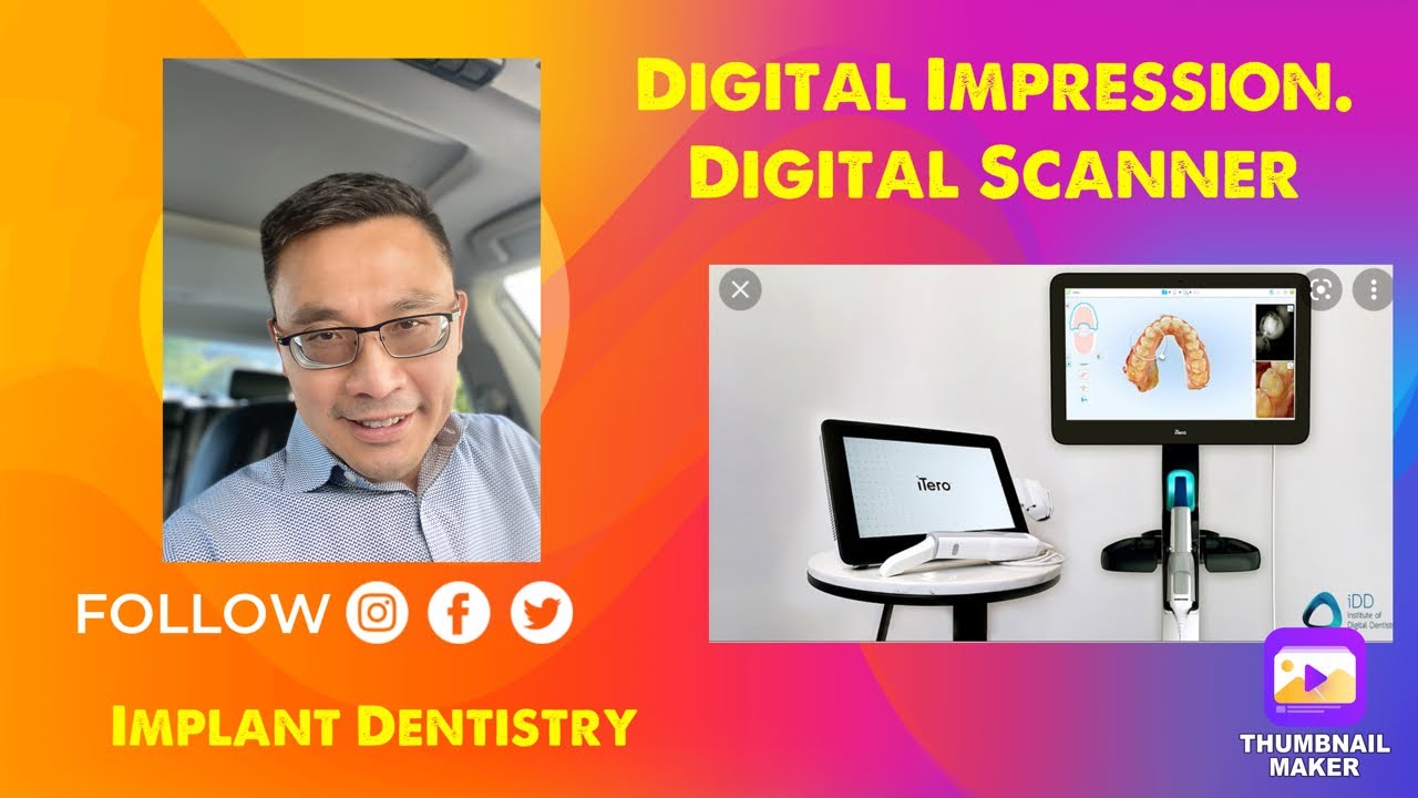 Digital Implant Crown Impression. 3D Scanner. Medit500. Medit700 ...