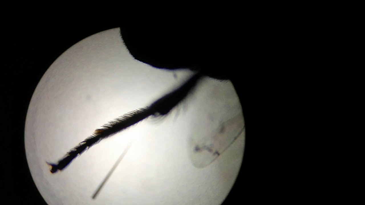 Metathoracic leg of a bee under microscope(10x) - YouTube