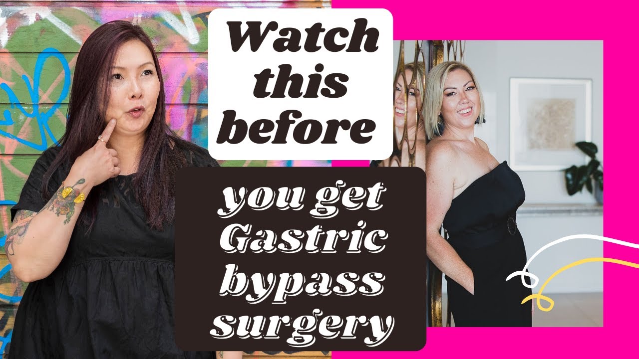 Should I Get Gastric Bypass Surgery Pros Cons Reality Youtube