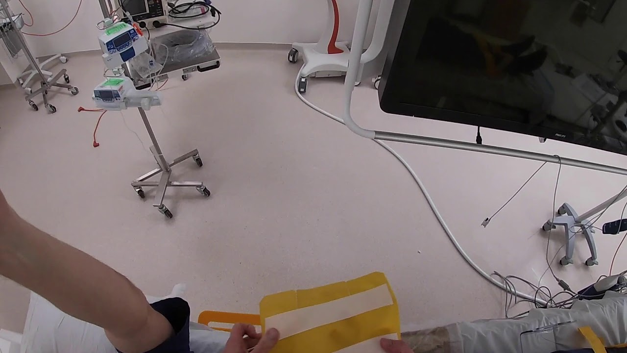 Radial Cradle® Arm Support Extend - YouTube