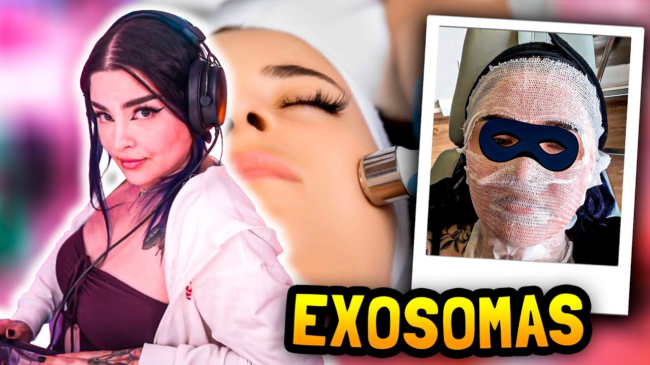 CAPRI HABLA DE SU TRATAMIENTO DE EXOSOMAS - YouTube