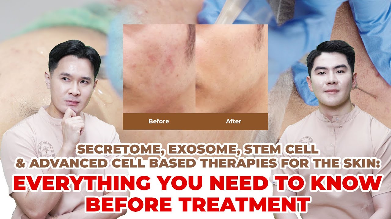 Secretome, Exosome, Stem Cell & Advanced Cell Therapies for the Skin ...