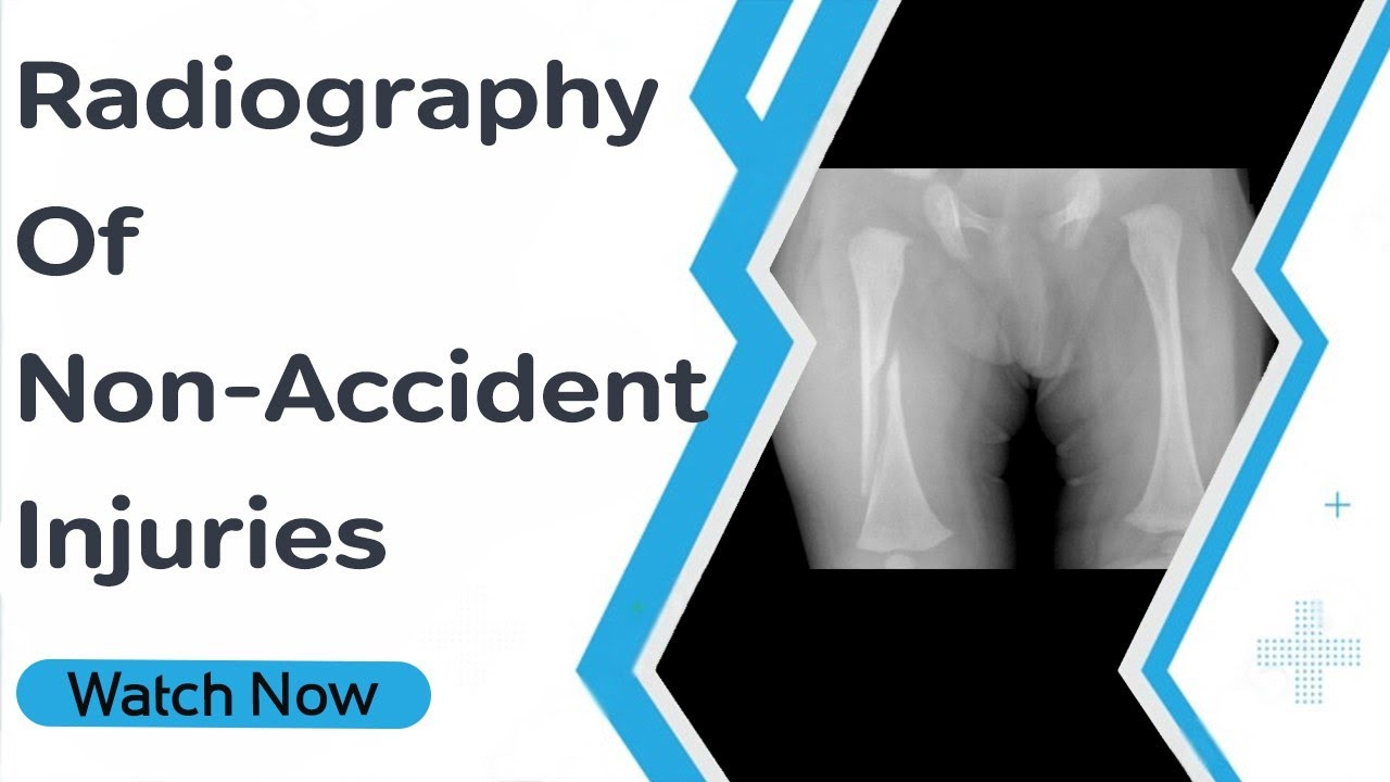 Radiography Of Non-Accident Injuries - YouTube