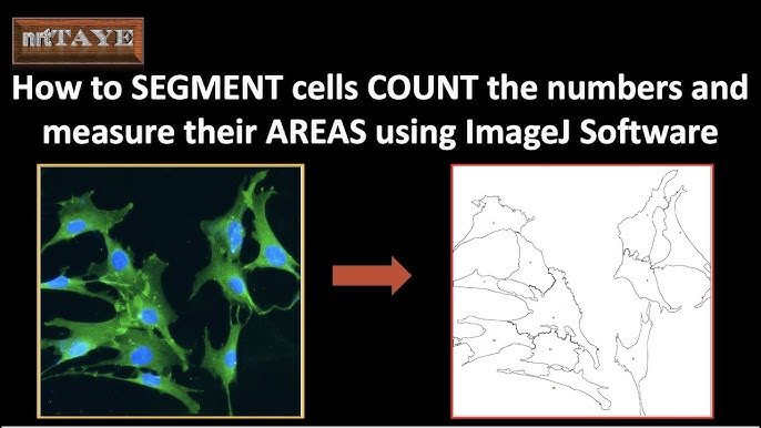 Measuring Cell Fluorescence Using Imagej Two Ways To Count Cells With