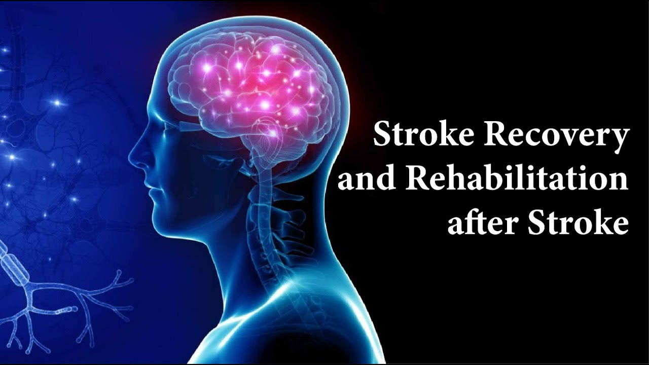 Stroke Recovery and Rehabilitation after Stroke | Neurology | Dr. Tapas ...