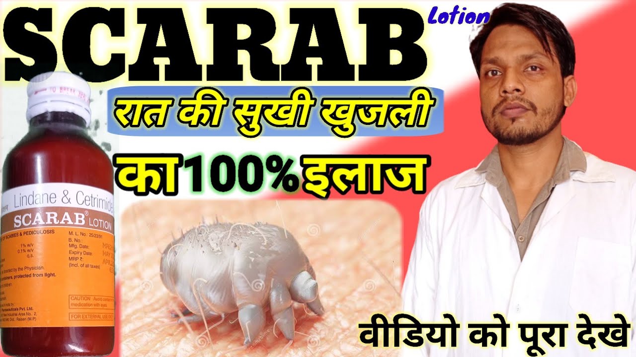 Scarab Lotion||scabies (रात की खुजली) treatment ||Scarab Lotion kese ...