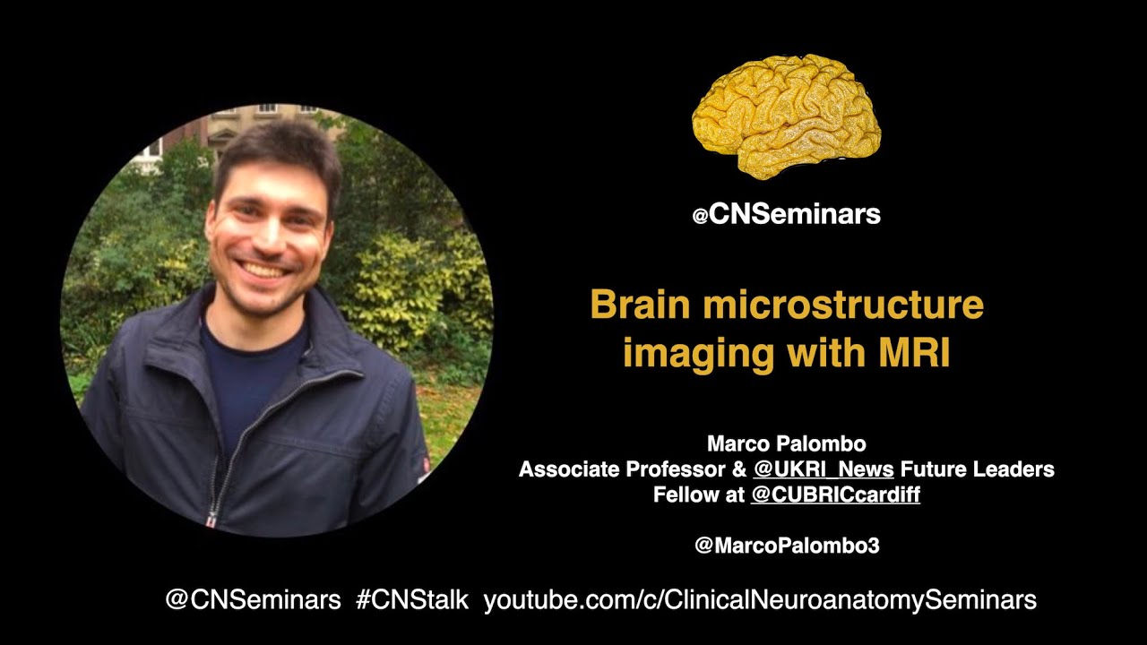 #CNStalk - Marco Palombo on Brain Microstructure Imaging with MRI - YouTube