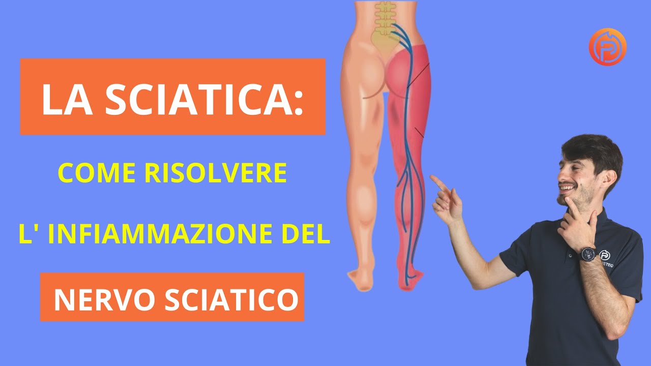 La SCIATICA. Infiammazione del nervo sciatico. Come trattarla. (2022 ...
