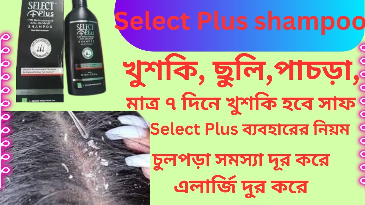 Select Plus shampoo খুশকি দূর করার কার্যকরী শ্যাম্পু। - YouTube