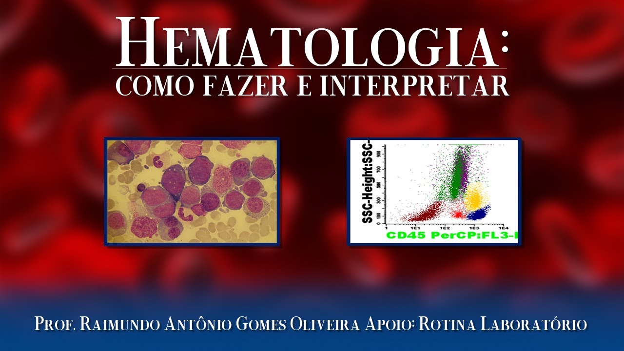 ERITOGRAMA SUGESTIVO DE ELIPTOCITOSE HEREDITÁRIA - YouTube