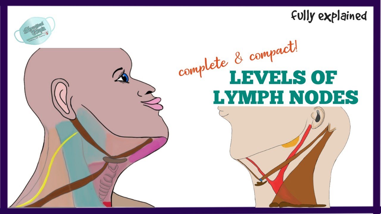 LEVELS OF LYMPH NODE IN NECK || ORAL CANCER || MALIGNANCY - YouTube