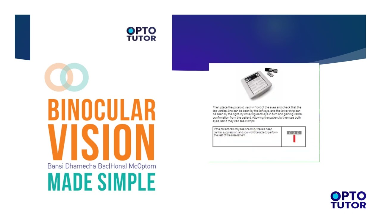 Mallet Unit - YouTube