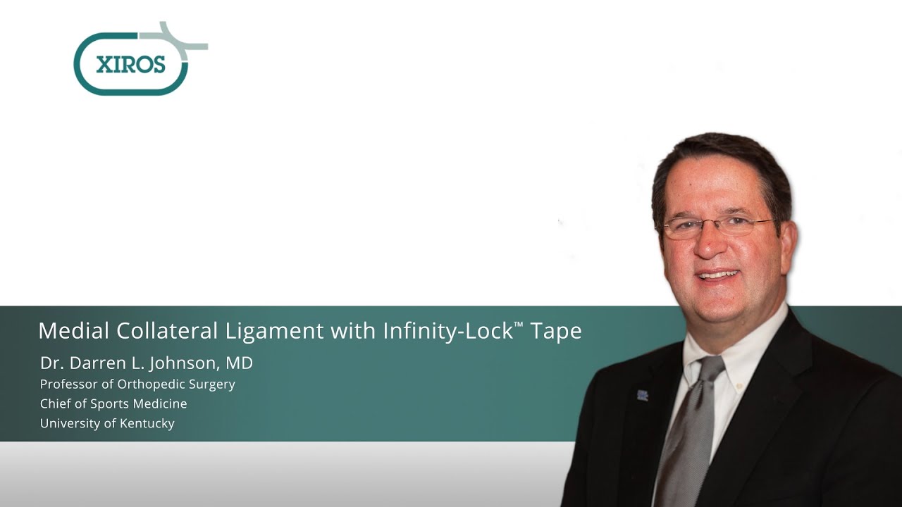 Medial Collateral Ligament reconstruction with Infinity-Lock™ Tape ...