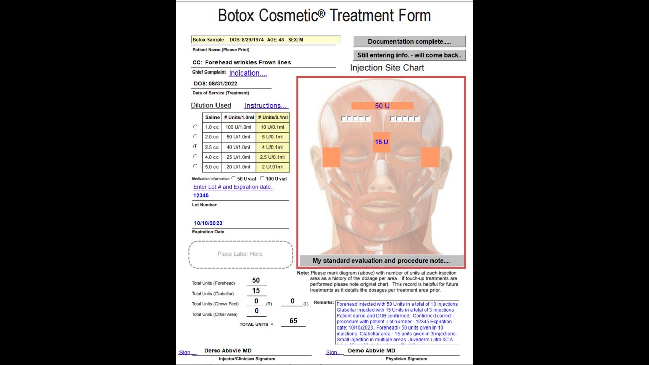AbbVie Botox Example - YouTube