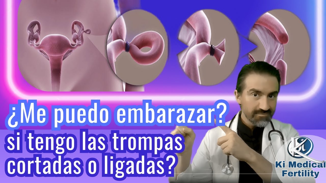 Foto De Trompas Cortadas - NAZAEDU