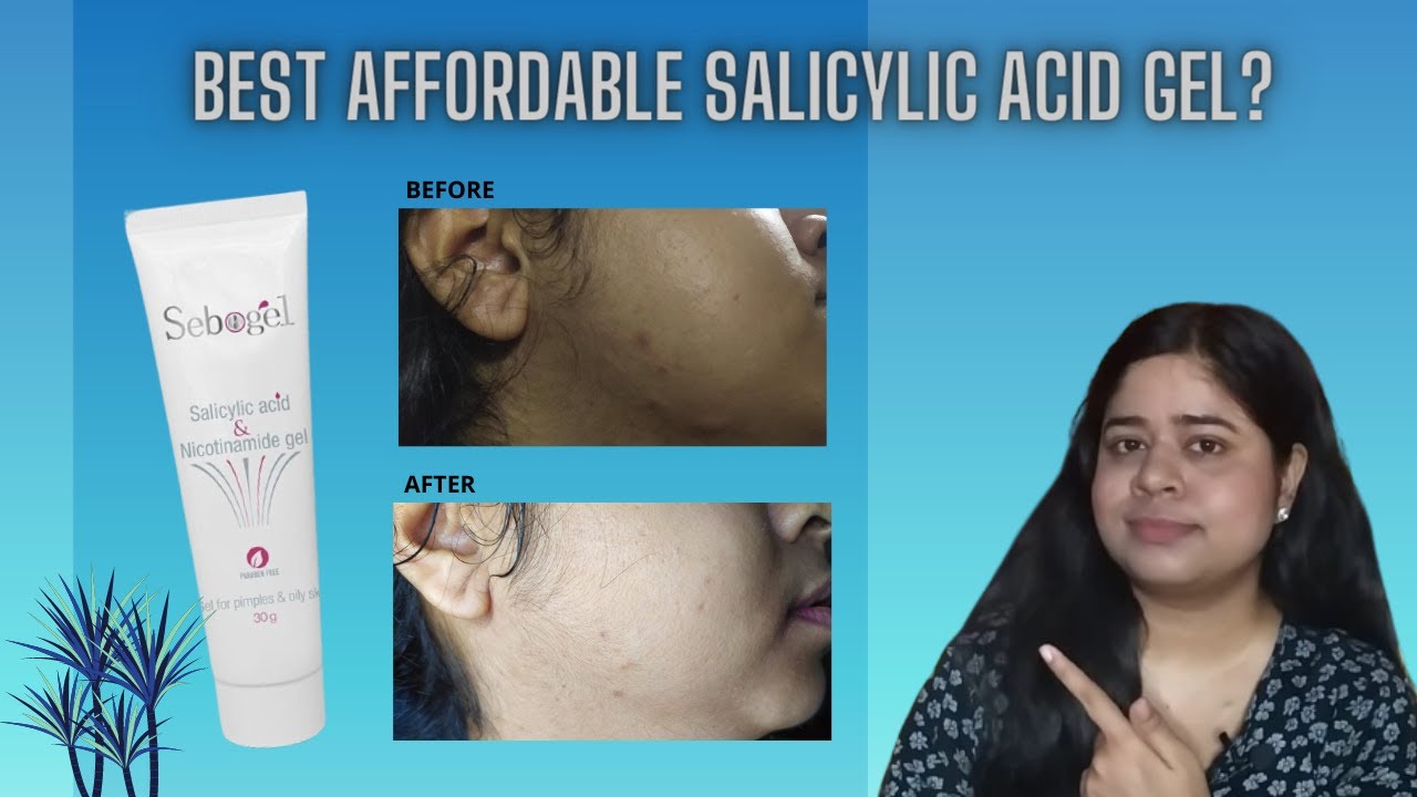 Sebogel Salicylic Acid Gel Review - YouTube