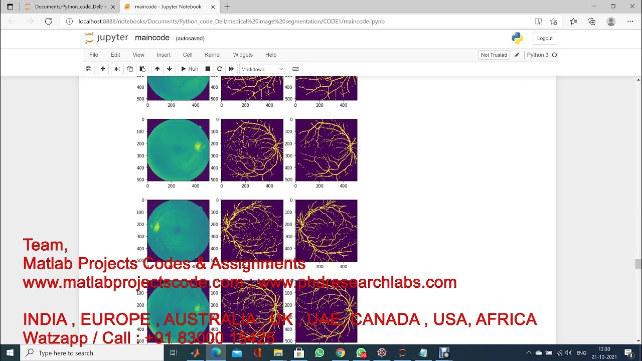 Medical image - Retina Vessel segmentation using Optimized Deep learning U-Net CNN || Python ...