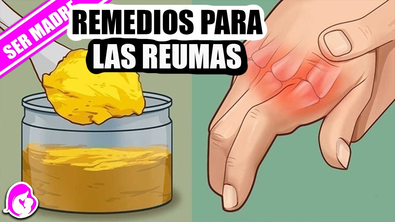 Remedios caseros para las reumas, los más efectivos - YouTube