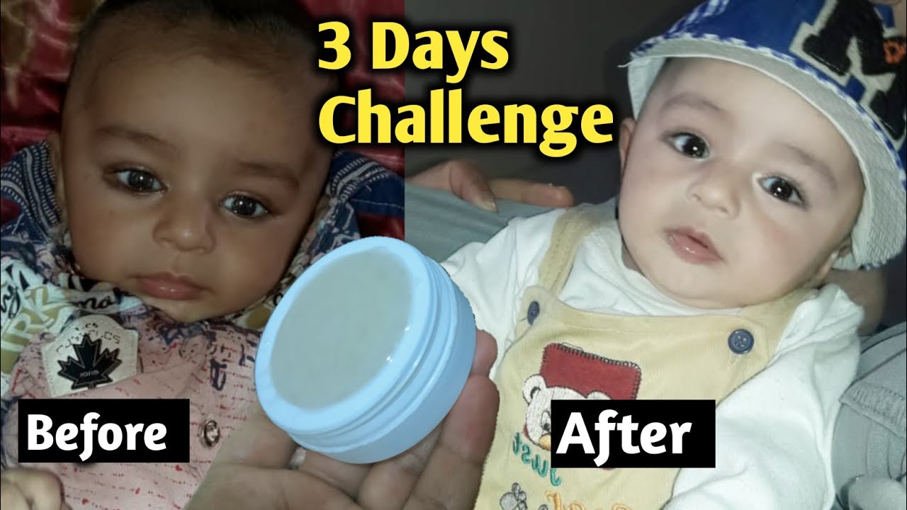 💯 Safe Homemade Baby Skin Fairness Cream | Make Baby Color White ...