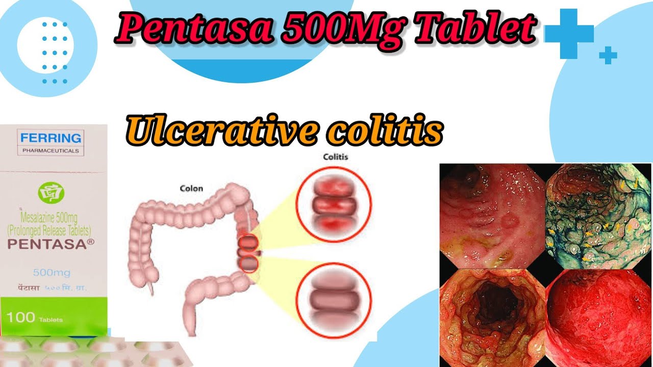 Pentasa 500Mg Tablet Use/Benefits/Side Effects/*Ulcerative Colitis ...