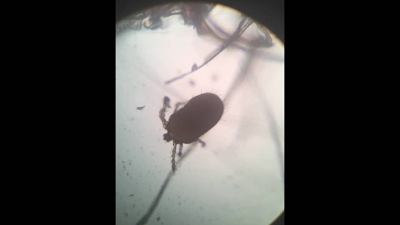 A Harvest Mite under the microscope! - YouTube