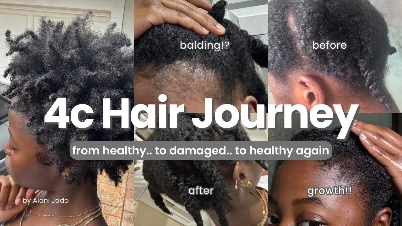 My 4c Hair Journey | how I got my hair back healthy + products ...
