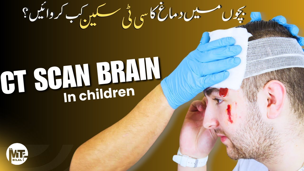 CT scan in a child in 2 minutes| Indications in less than 16 years old ...