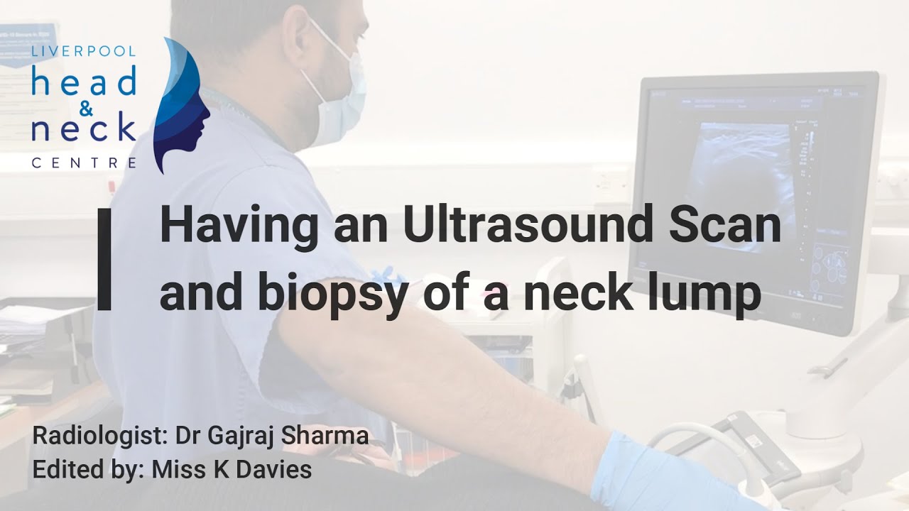 Having an Ultrasound Scan and biopsy of a neck lump - YouTube