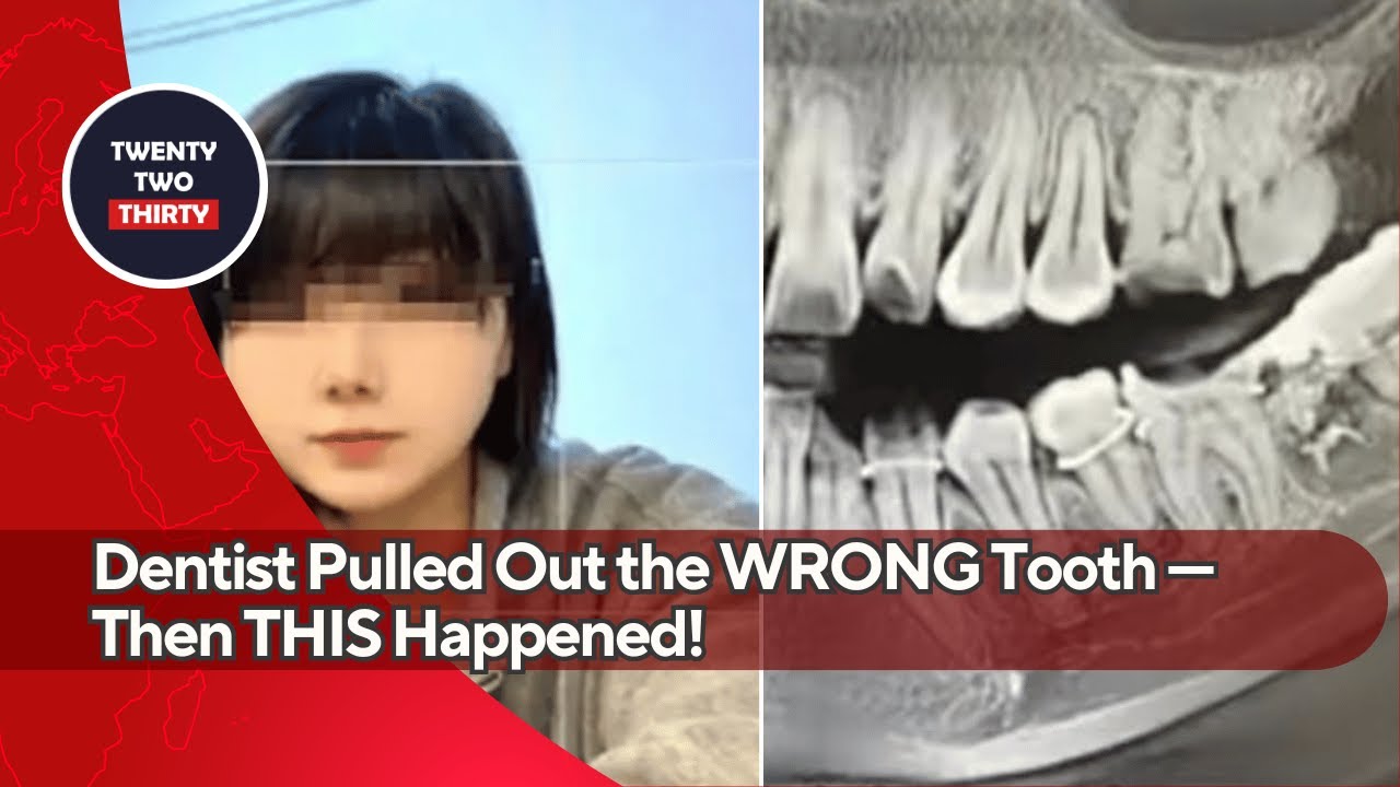 Dentist Pulled Out the WRONG Tooth — Then THIS Happened! Shocking ...