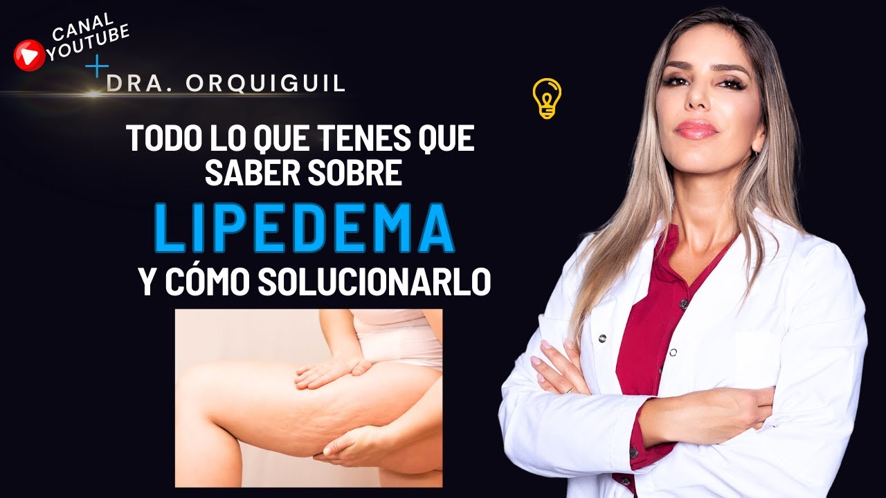 CIRUGÍA DE LIPEDEMA. TODO LO QUE TENES QUE SABER ANTES DE OPERARTE ...