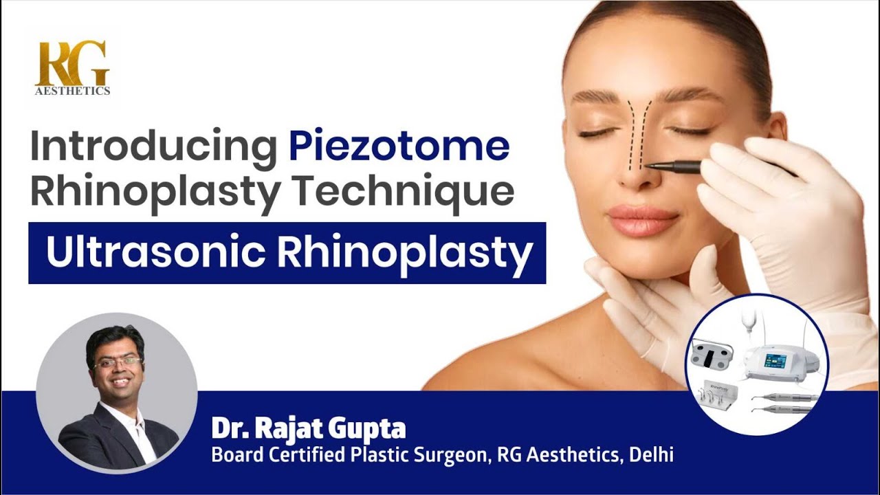 Introducing Piezotome Rhinoplasty Technique | Ultrasonic Rhinoplasty ...