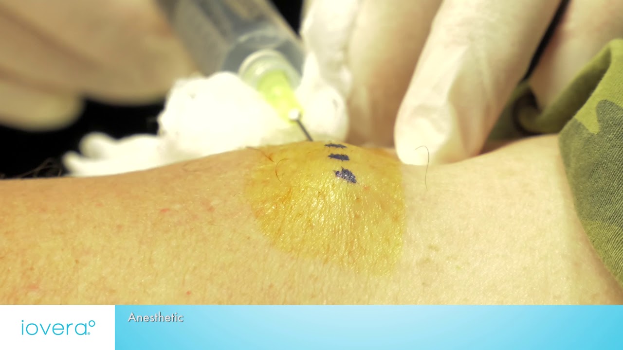 Treatment Training AFCN & ISN - YouTube