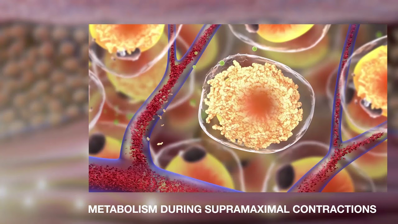 Emsculpt in DC - Body Contouring Animation - YouTube