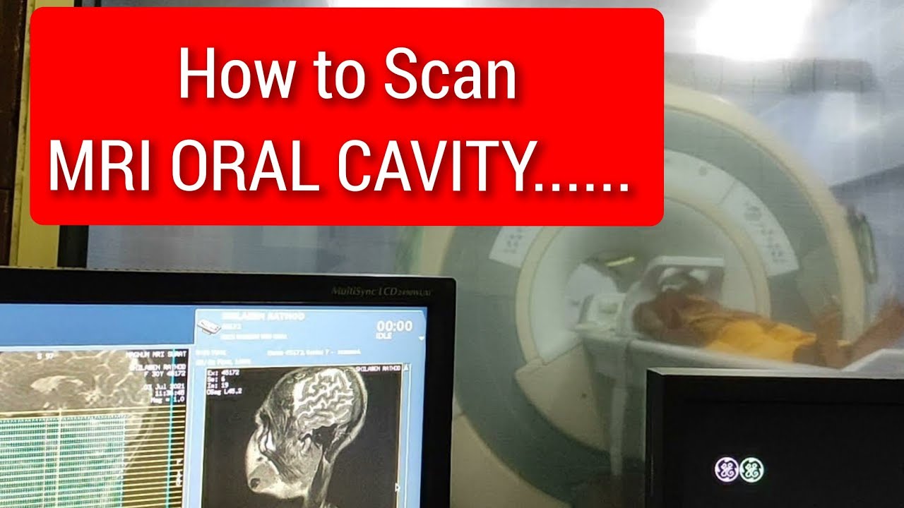 Oral Cavity MRI scan protocol, positioning and planning | MRI Neck-PNS ...