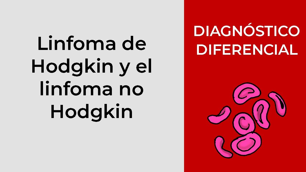 Linfoma De Hodgkin