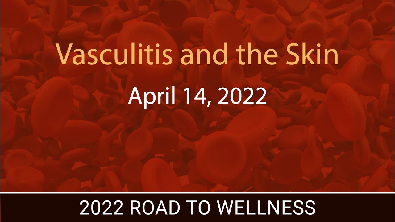 Kidney Involvement - Vasculitis Foundation