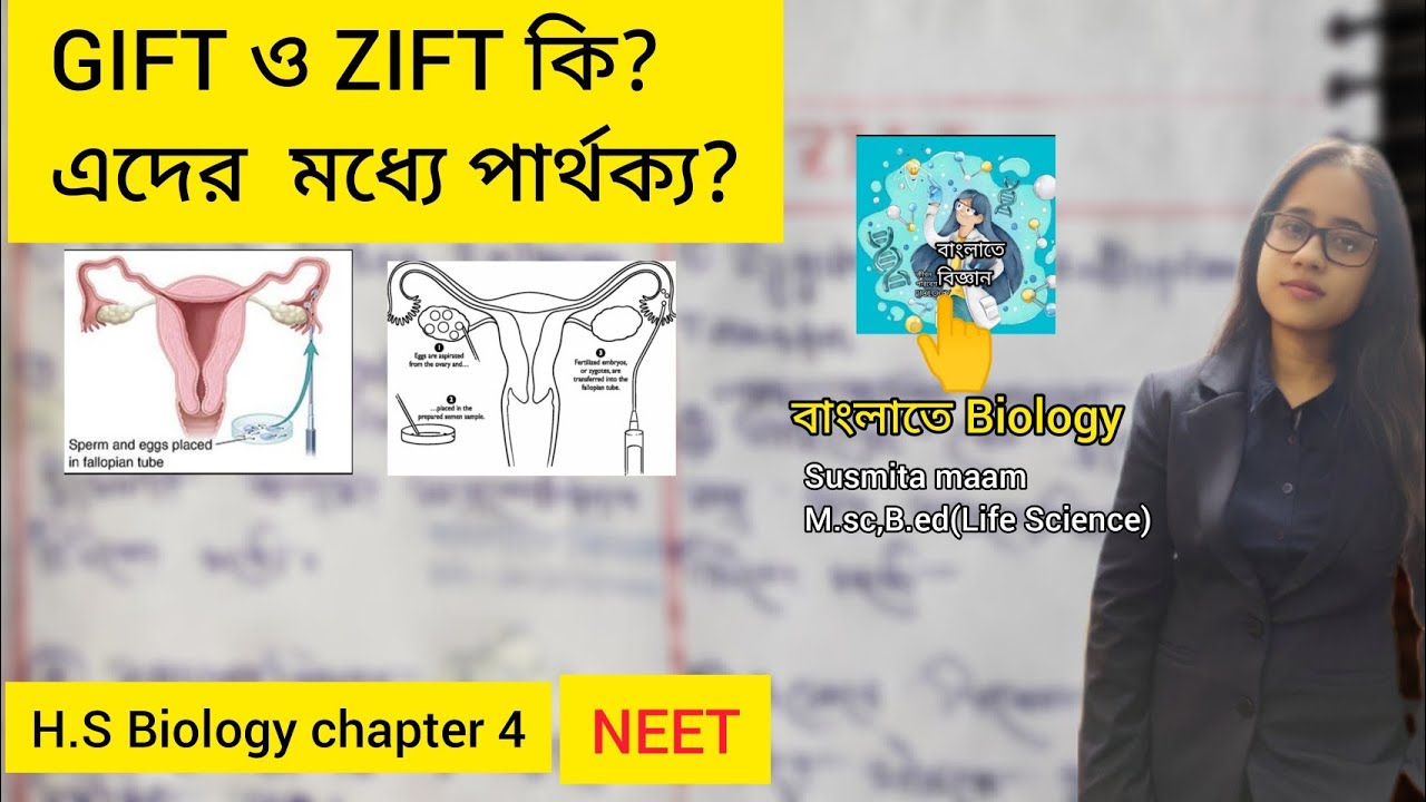 GIFT vs ZIFT bangla|GIFT ও ZIFT-এর মধ্যে পার্থক্য|Difference between ...