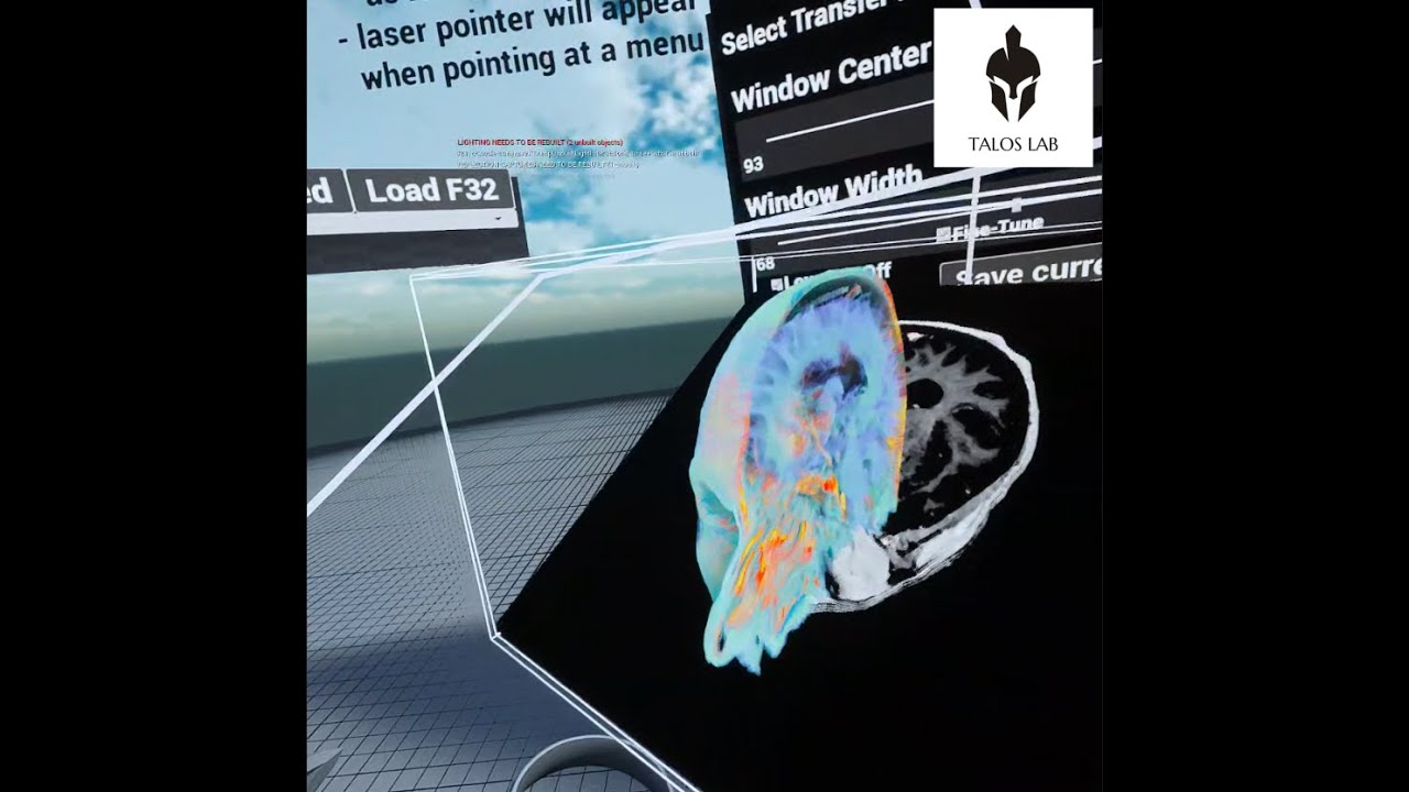 Human Brain Scan // Dicom - YouTube