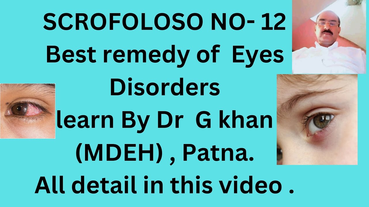 Scrofoloso no 12 // Best remedy( medicine) of eyes // details with ...