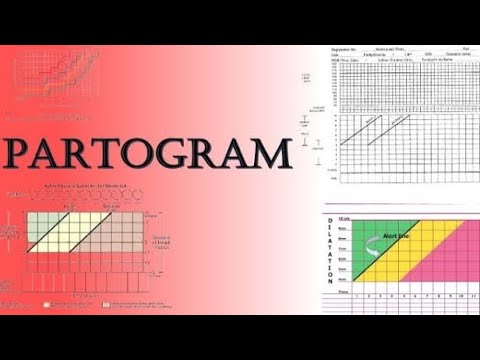 شرح محاضرة partogram بطريقة مبسطة و سهل - YouTube