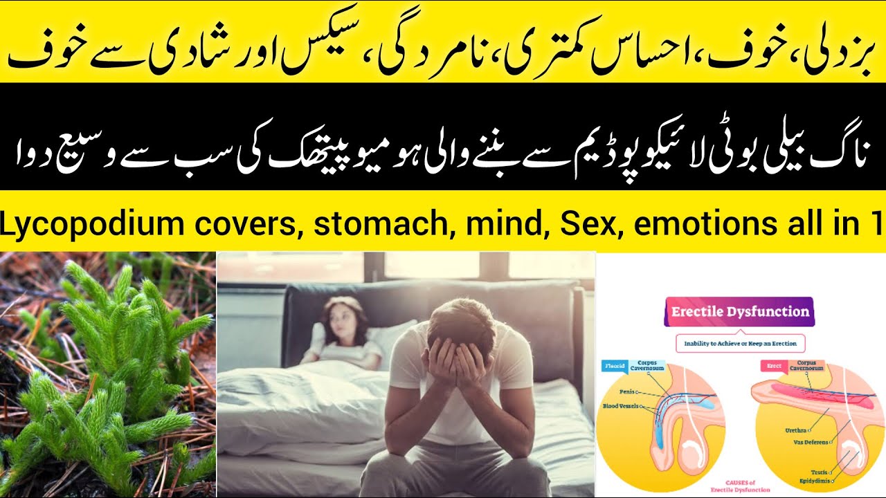 My Clinical Cases, A presentation of patient of #lycopodium on clinic with pathology, # ...